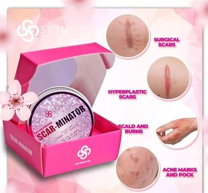 On Hand Original And Effective Scarminator Cream By Skin Sensation 40g