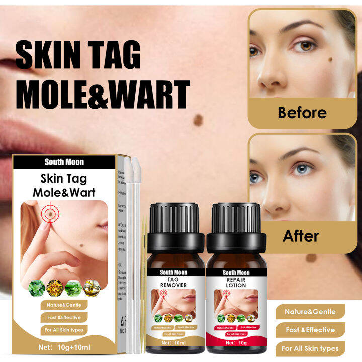 ร้านขายของชำแก้กังวล Dot mole potion non-trace Point mole plaster water plant remove mole remove ...