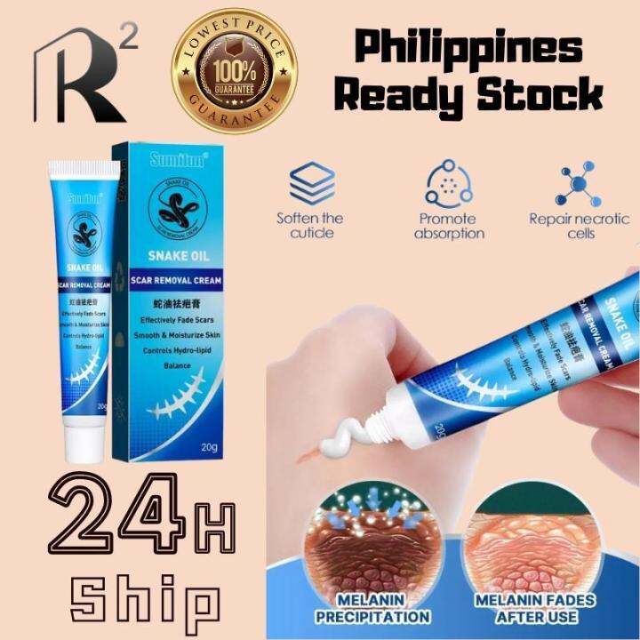 sumifun Professional snake oil ointment, freckle cream, acne treatment ...