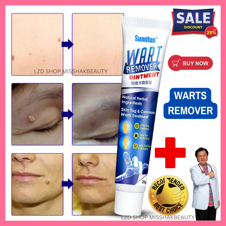MEGA SALE Effective Warts Removal Ointment Original Wart Cream Plantar ...