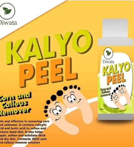 W.J.C.PH Kalyo Peel Corn and Callous Remover /GALIS | Lazada PH