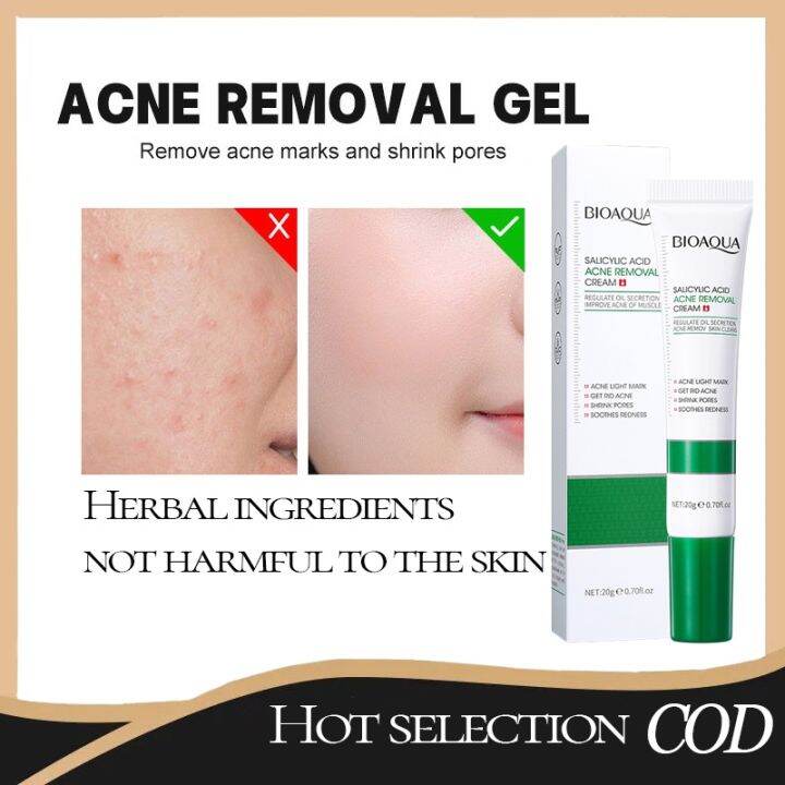 Cream For Face Removing Pimples Remove Acne Treatment Gel Scars Remover ...