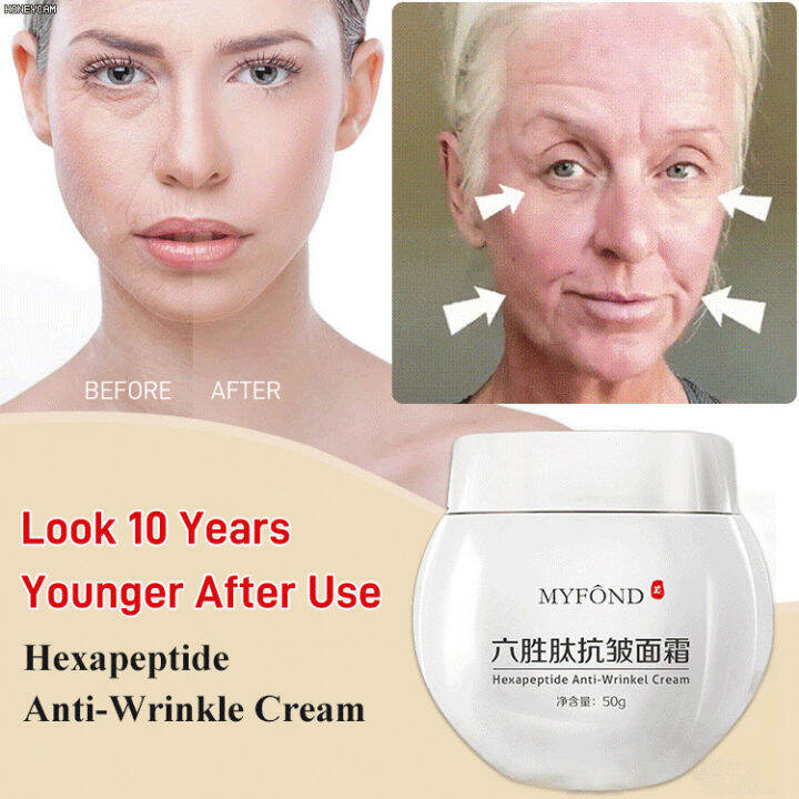 yidaoguang Water Soluble Collagen Protein Thread | Lazada PH