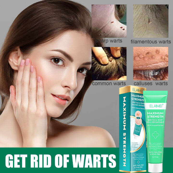 ELAIMEI Warts Remover Cream Skin Tag Remover Hand foot face armpits ...