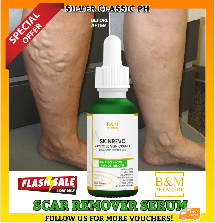 B&M PREMIERE SKINREVO VARICOSE VEIN ESSENCE SERUM | Lazada PH