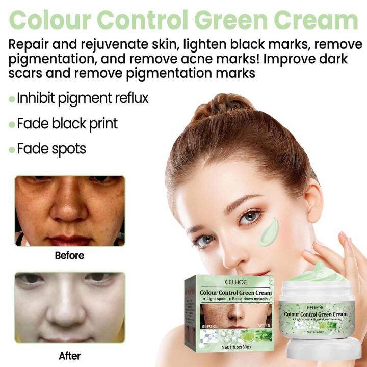Lightening Spot Color Control Cream Lightening Melasma Pigmentation ...