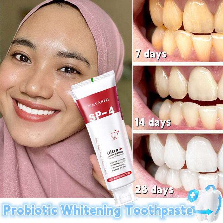 ubat gigi Teeth white teeth sp4 toothpaste whitening toothpaste teeth ...