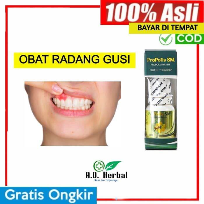 (Turun Harga!!) Obat Radang Gusi - Sakit Gigi Berlubang - Obat Gusi Bengkak & Sakit | Lazada ...