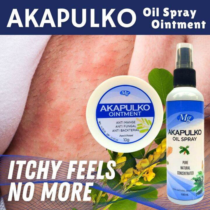MG AKAPULKO OIL SPRAY 100ML & OINTMENT 10G Pure Anti-Mange Spray ...