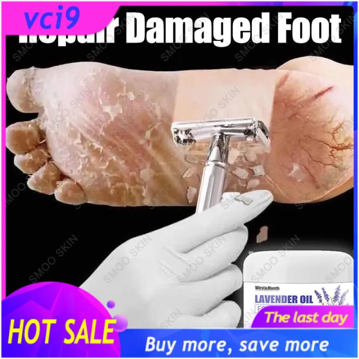 Hot 】Buy 2 Take 1COD Foot Spa Callus Remover Foot Cream Moisturizing ...