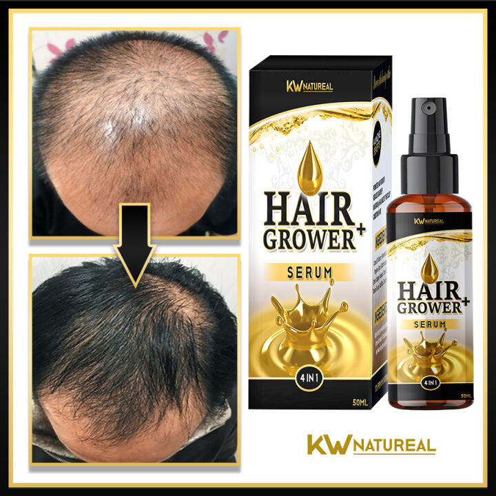 ORGANIC HAIR GROWER PLUS SERUM SPRAY BY KW NATUREAL EFFECTIVE ANTI HAIR ...