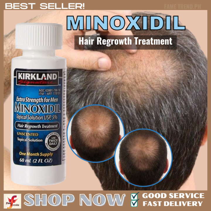 Best Seller Kirkland Minoxidil Revitalizes Hair Follicles Clinically
