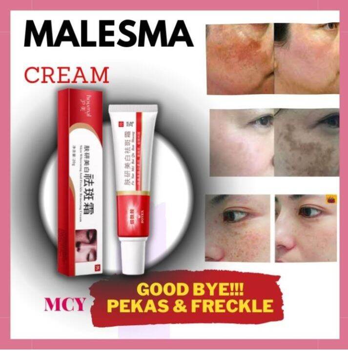 Melasma Cream Pekas Remover Dark Spots Remover Brighten Skin Anti-Aging ...