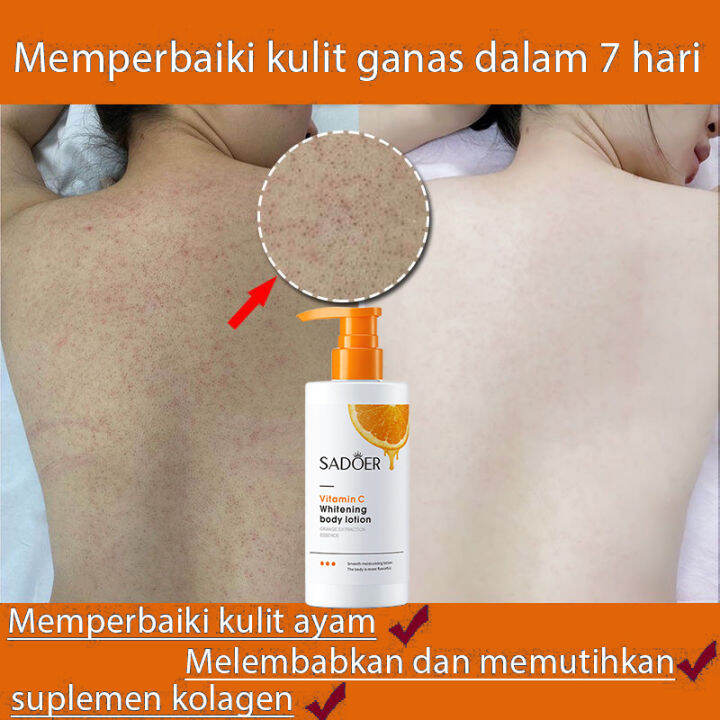Body Whitening Vitamin C Body Lotion SADOER Body Lotion Vitamin C Whitening Body Lotion Extra ...