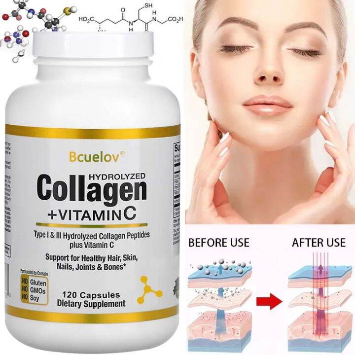 bcuelov Hydrolyzed Collagen Peptides + Vitamin C, Type I & III supports ...