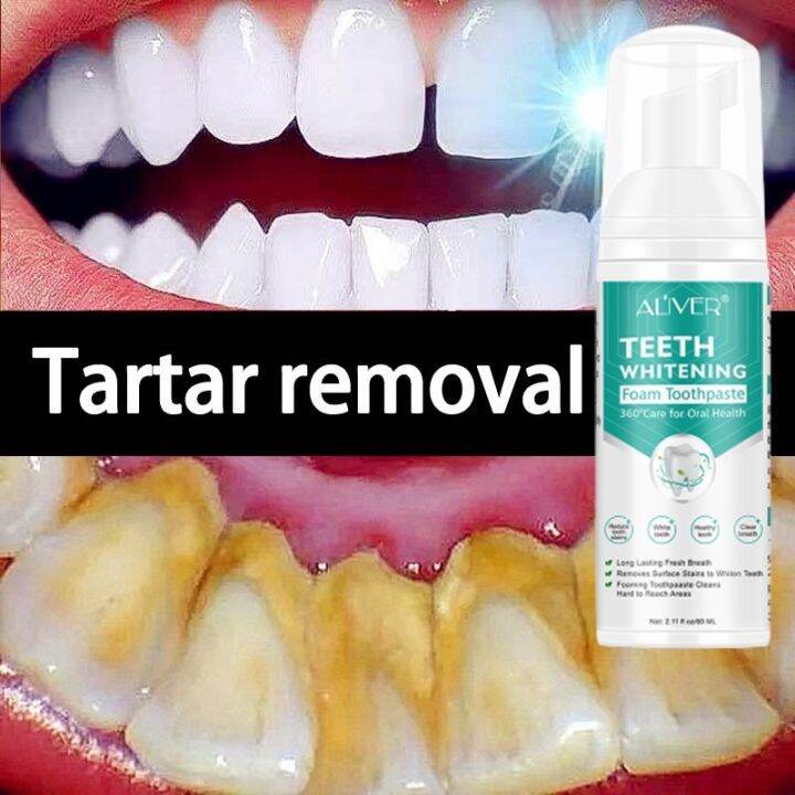ALIVER Teeth whitening mousse toothpaste Remove Tartar Remove Plaqu ...