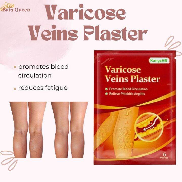 Original and Effective Pain Relief Varicose Veins Plaster Patch 6Pcs ...