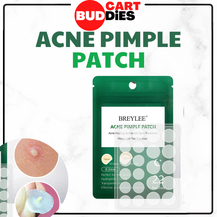 Acne Pimple Patches Hydrocolloid Stickers Pimples Removal Facial Skin ...