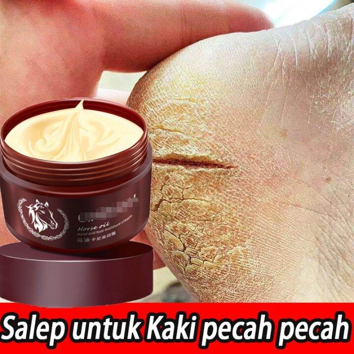 horse oil Obat Kaki Pecah Dan Kering Hand Foot Cream Anti Retak, Krim ...