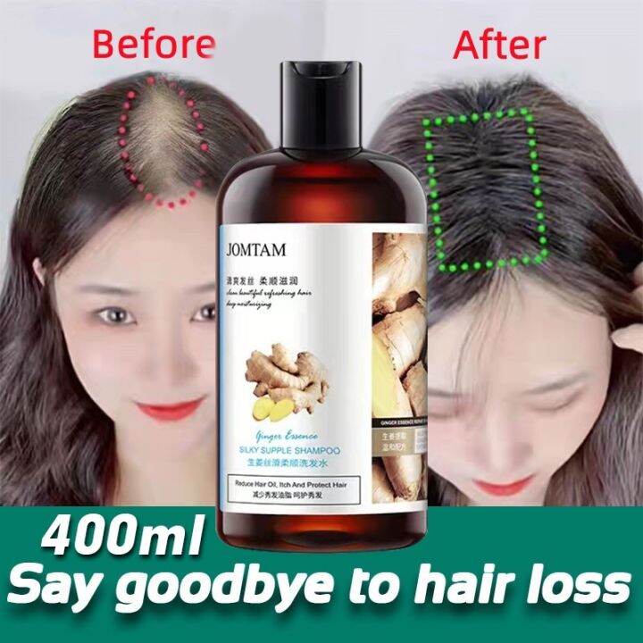 COD hair growth shampoo anti dandruff cure conditioner dry aloe vera ...