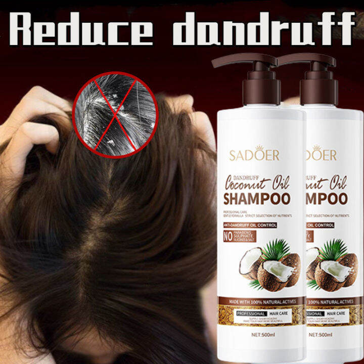 Coconut Shampoo Oil Control Shampoo Fluffy Anti-Dandruff Anti-Itching Fragrance Shampoo | Lazada PH