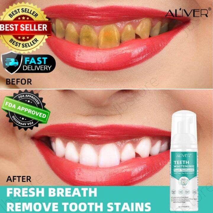 COD Original ALIVER Teeth Mousse Toothpaste Yellowing of Foam Cavity ...