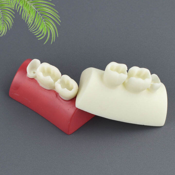 Dental Resin Block Filling Exercise Inlay Practice Model Dental Model ...