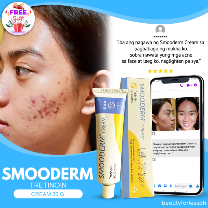 SMOODERM TRETINOIN / 0.5% CREAM / ANTI-ACNE CREAM / ANTI-AGING / ANTI ...