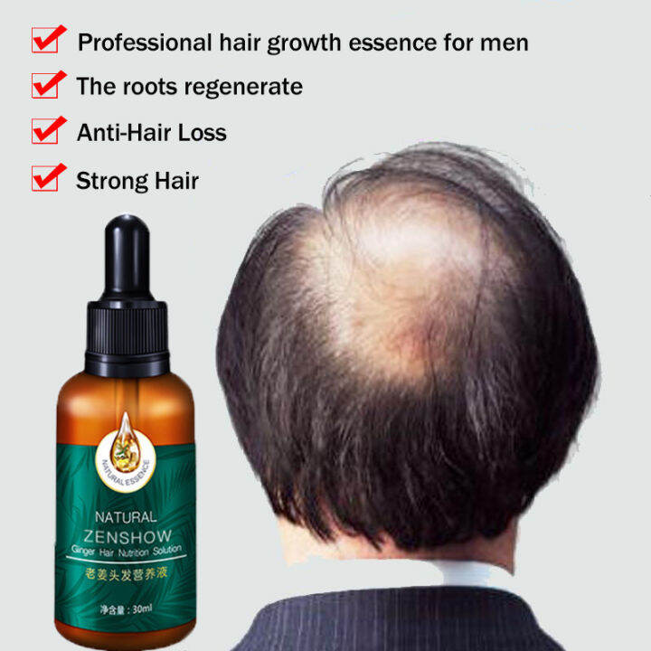 100 Effective Hair Grower For Men Original Minoxidil Hair Grower