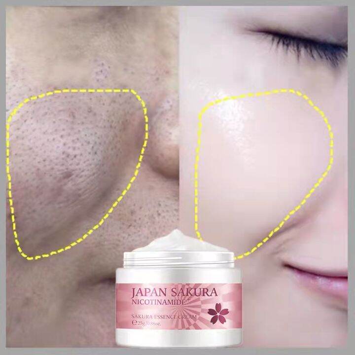 Japan Sakura Nicotinamide Cream Anti Aging Whitening Acne Pimple ...