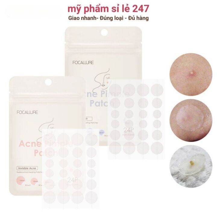 miếng dán mụn che khuyết điểm Focallure 24 Miếng miếng dán hút mụn mủ mụn nhọt nhân mụn ngừa ...