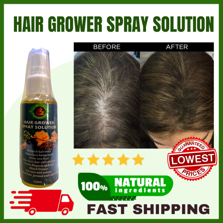 HAIR GROWER SPRAY SOLUTION | Lazada PH