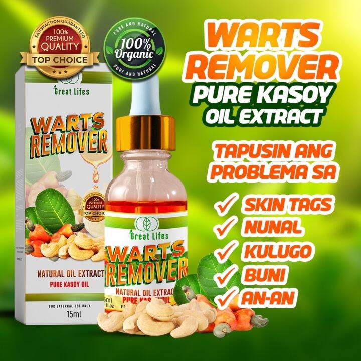 Warts Remover Ointment Kasoy Oil Tanggal Nunal Kulugo Kalyo Kulugo Buni ...