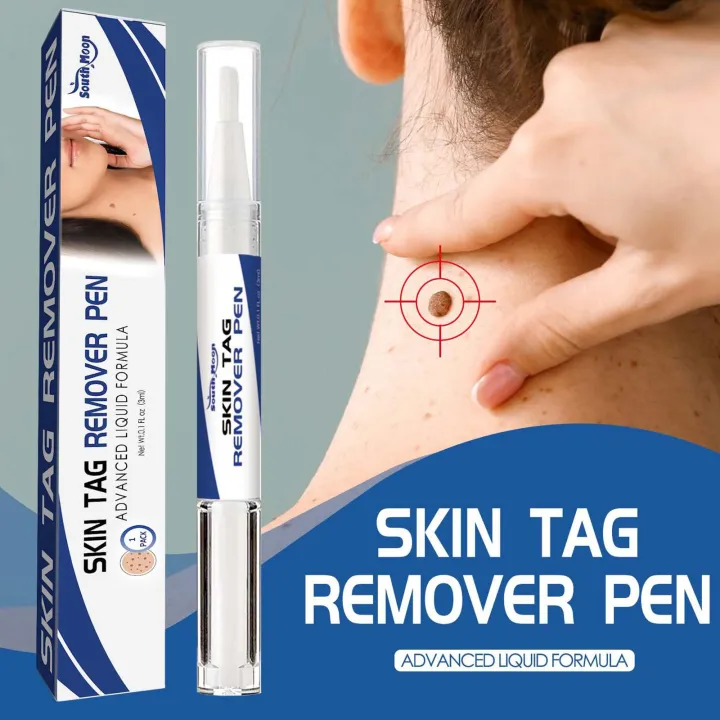 Skin Tags Remover Pen Rubber Bands Beauty Health Wart Removal Patches ...