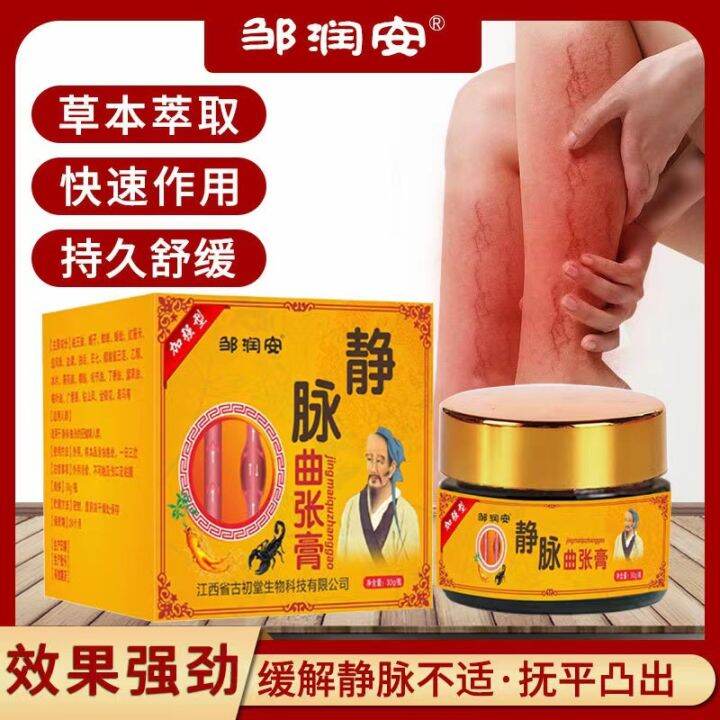 Varicose Vein Treatment Cream Repair Phlebitis Treatment Vasculitis ...