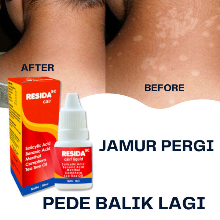 KAMNESYA - RESIDA CAIR 10ml SEBAGAI PENGGANTI KALPANAK kalpanax CAIR ...
