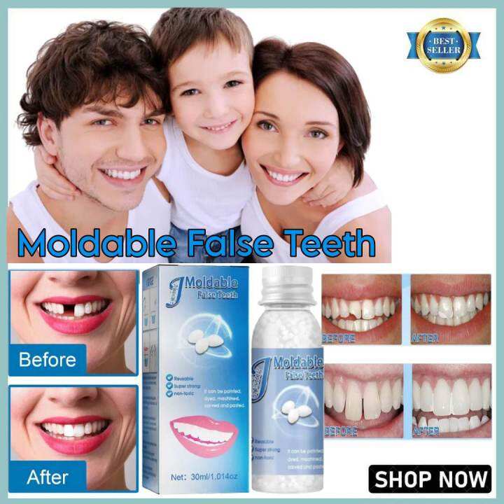 BEST SELLING!!! Teeth Repair Kit Temporary Teeth Replacement Kit ...
