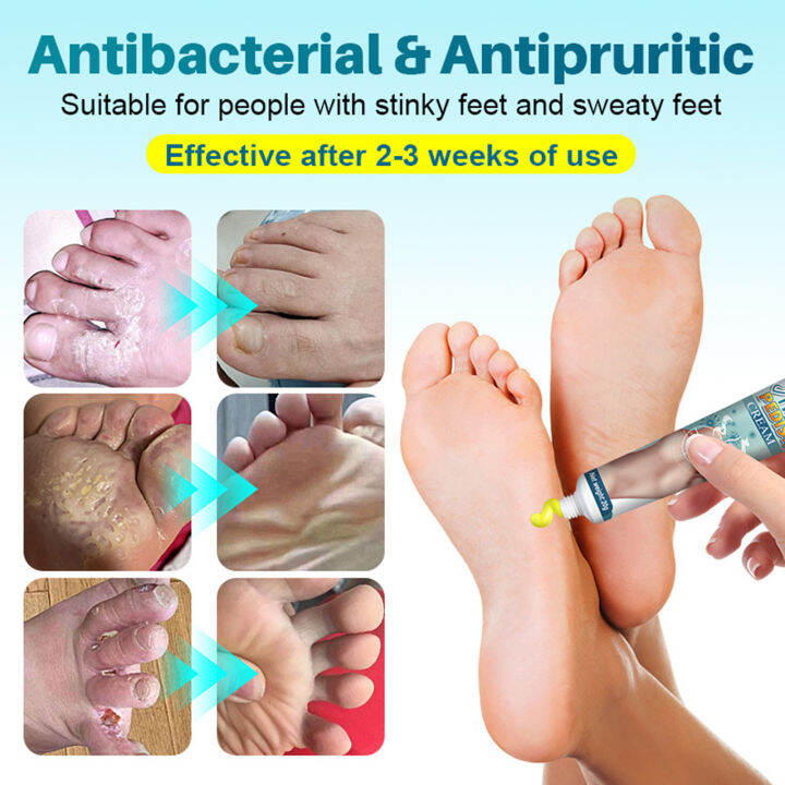 Foot Tinea Pedis Care Cream Anti-Itch Odor Removing Foot Care Cream for ...