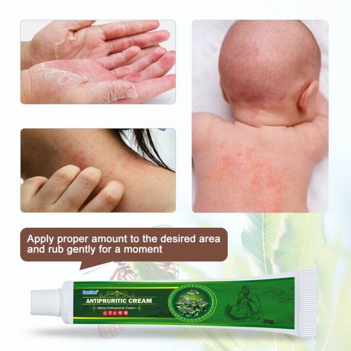 ☂Sumifun Eczema Treatment Cream Gamot Sa Kati Kati Sa Balat Ointment ... ☂Sumifun Eczema Treatment Cream Gamot Sa Kati Kati Sa Balat Ointment ...