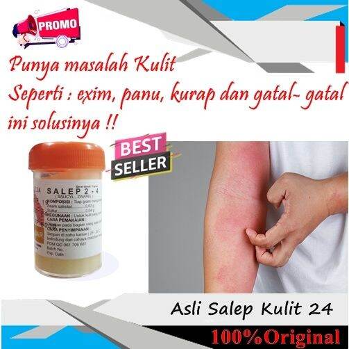 Flash Sale Salep Kulit 24 Gatal Jamur Obat Gatal Gatal Pada Kulit ...