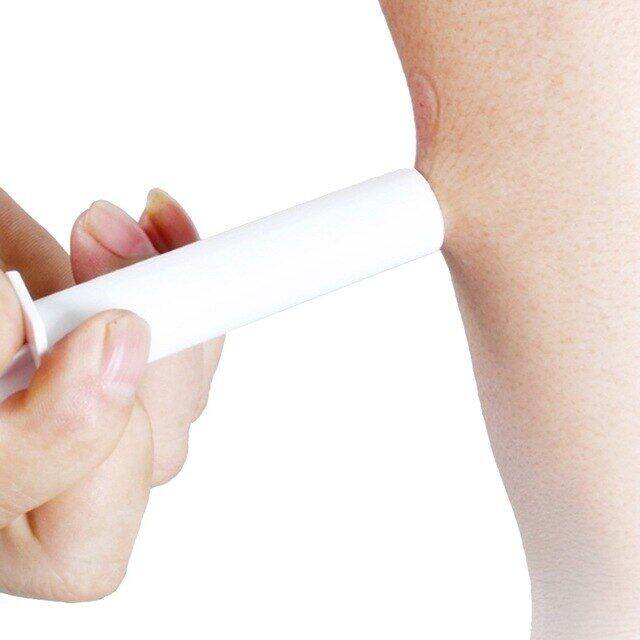 New 】 qiaojiug Vacuum Mosquito Bite Outdoor Pipette Extractor Tools Kit ...