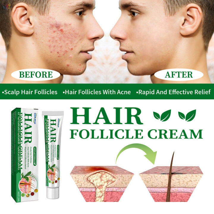 [La vis] Plant Formula Hair Follicle Cream Inhibit Bacterial Growth ...