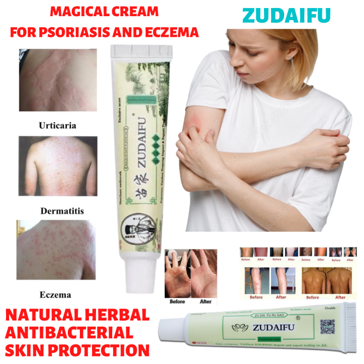 Zudaifu Cream Miracle Cream Ointment Allergy Itchy Skin Eczema ...