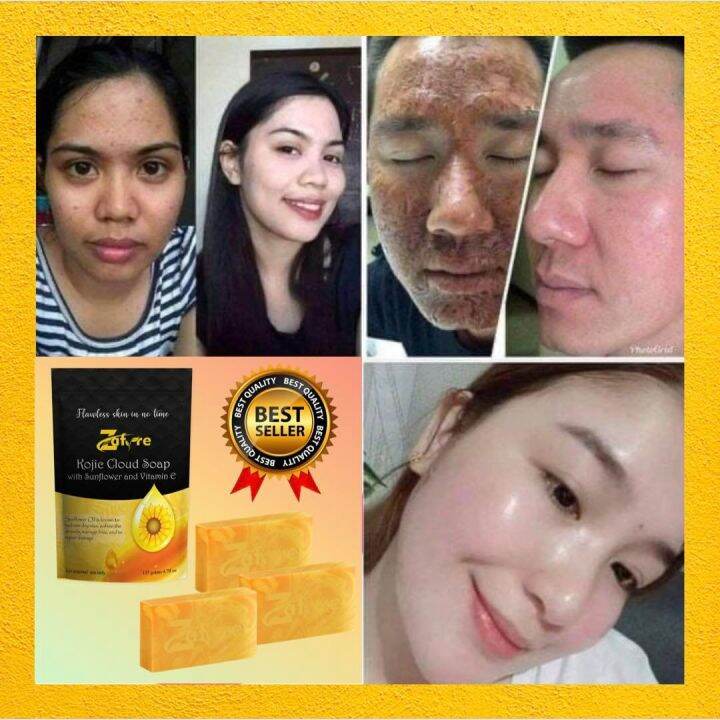 Zafyre kojic cloud soap with sunflower oil & vitamin e ,flawless skin ...