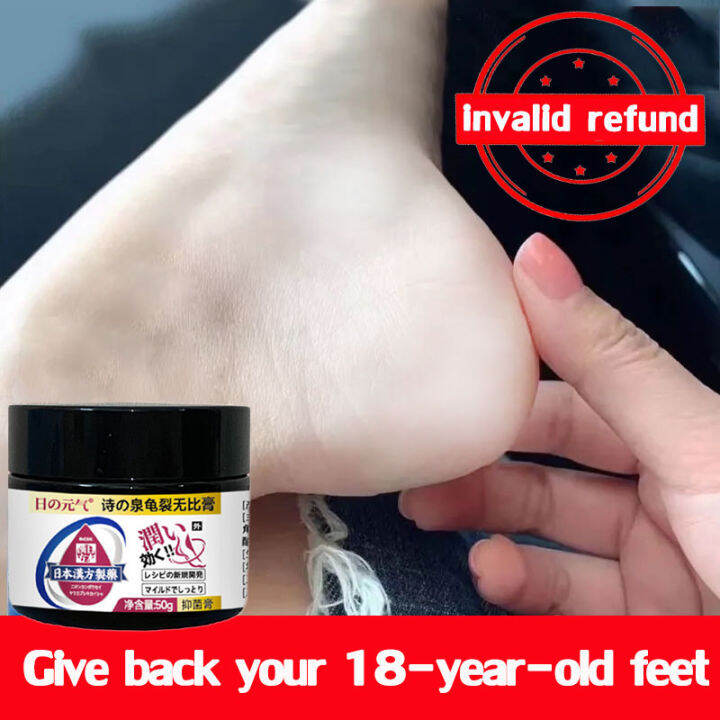Three day effective Hand and Foot Salve Cream foot care anti-cracking ...