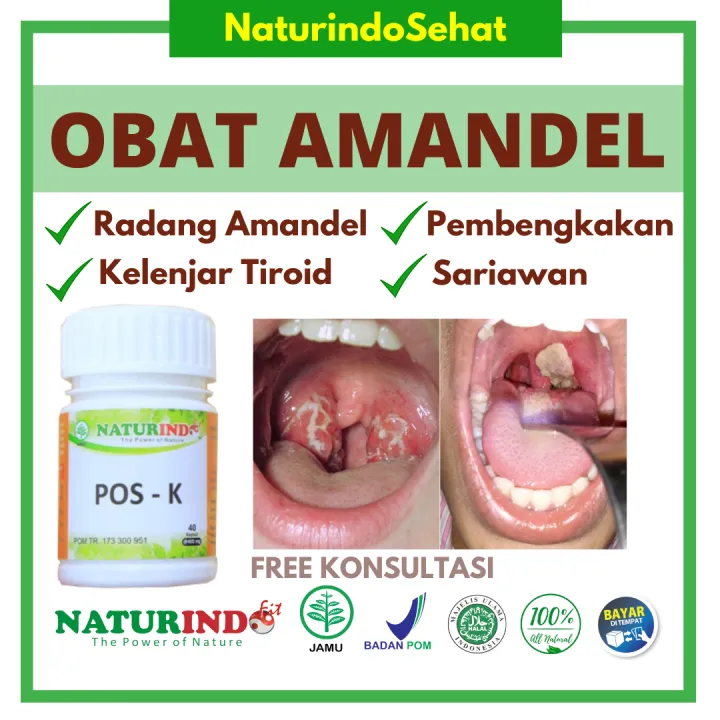 Obat Amandel Anak Dewasa Paling Ampuh Amandel Bengkak Obat Amandel ...