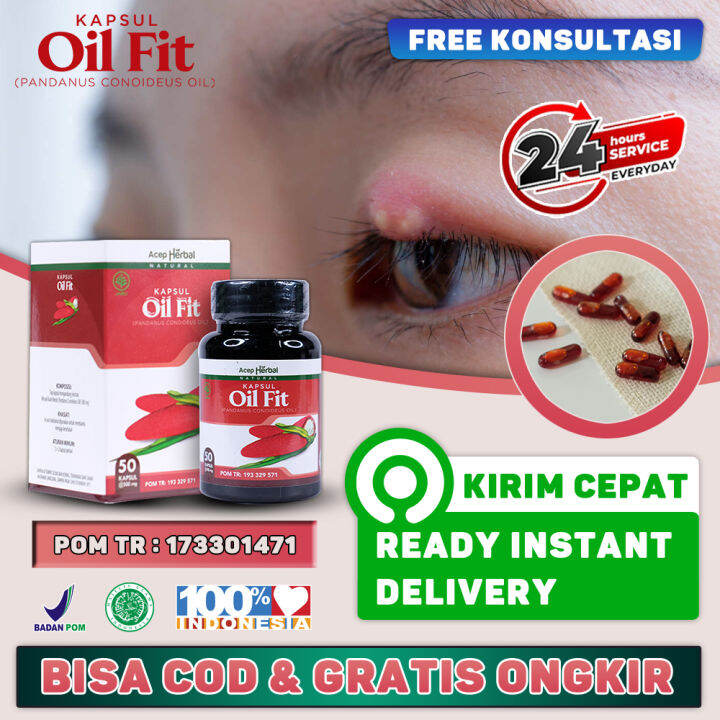 Obat Mata Timbilan Bintitan Iritasi Mata Merah Benjolan Mata Glaukoma ...