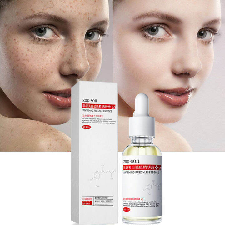 Brightening Fade Dark Spot Lightening Serum 30ML Effective Whitening Freckle Cream Serum Remove ...