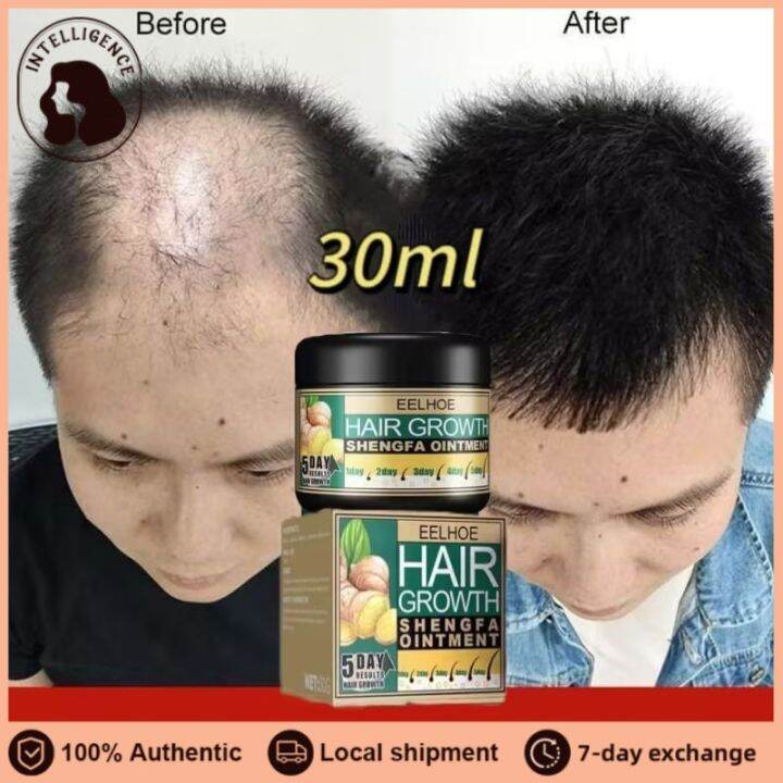 🎀🎀IE Eelhoe Minoxidil Hair Grower Original Moroccan Ginger Hair Growth ...