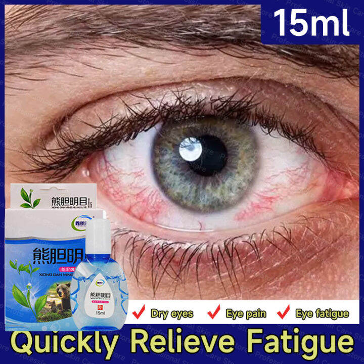 fresh and bright eye drops for clear vision 15ml,Relieve visual fatigue ...